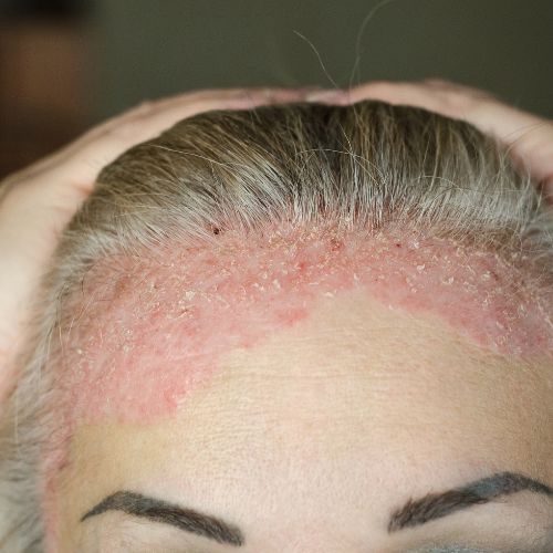 Clinical Resolution Lab | Understanding Hypersensitive Skin